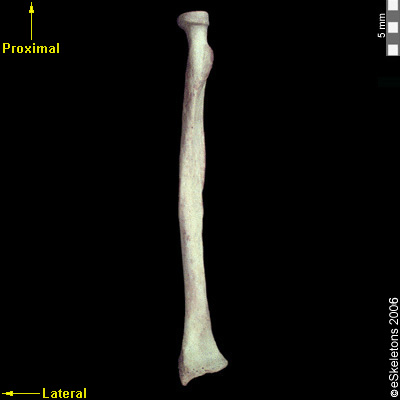 Osteology: Arm – FORENSICS
