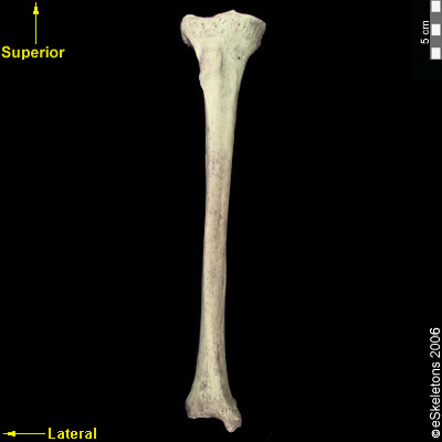 Osteology: Leg – FORENSICS
