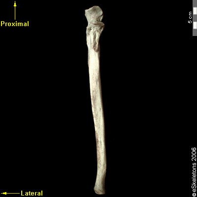 Osteology: Arm – FORENSICS