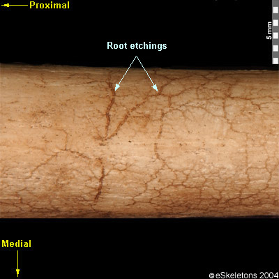 Burial Damage – FORENSICS