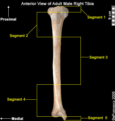 Stature Estimation – FORENSICS