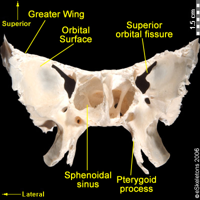 Osteology of the Skull: Cranial Bones of the Brain Case – FORENSICS