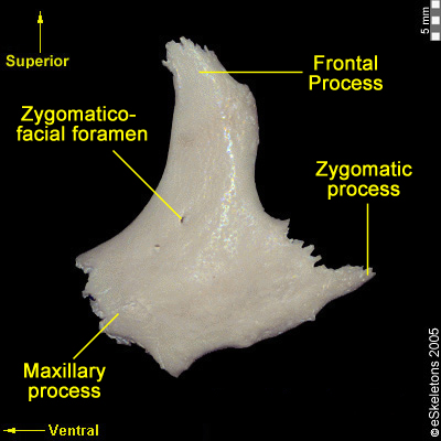Zygomatic Process Of Maxilla Wikidoc
