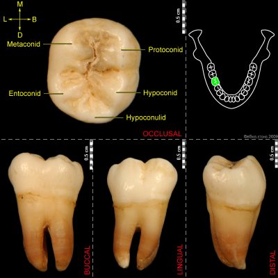 Dentition: Molars – FORENSICS