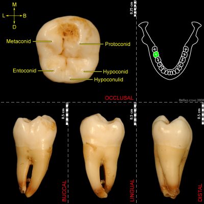 Dentition: Molars – FORENSICS