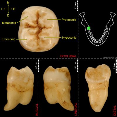 Dentition: Molars – FORENSICS