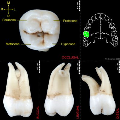 Dentition: Molars – FORENSICS