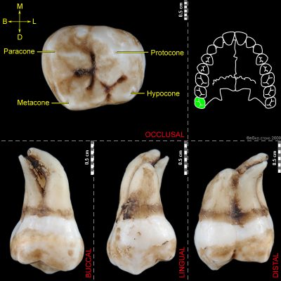 Dentition: Molars – FORENSICS