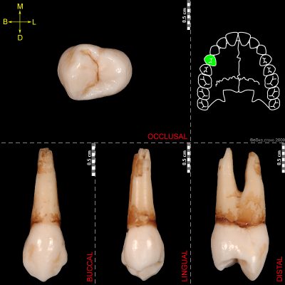 Dentition: Premolars – FORENSICS