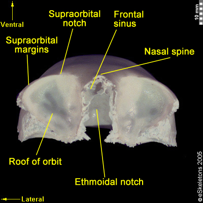Osteology of the Skull: Cranial Bones of the Brain Case – FORENSICS