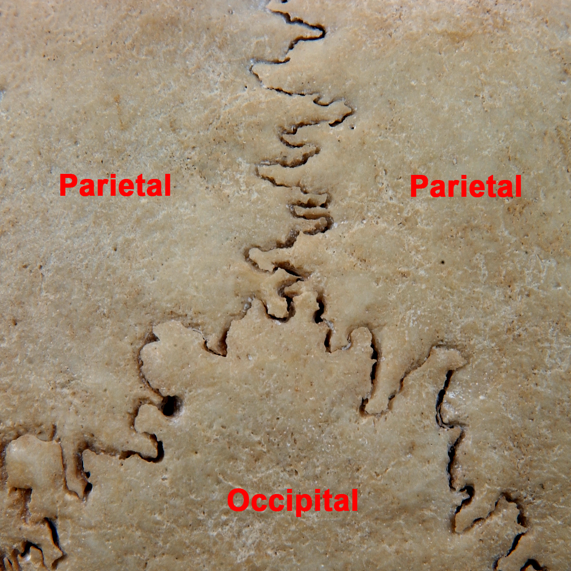 Osteology of the Skull – FORENSICS