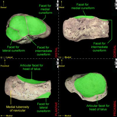 Osteology: Tarsus – FORENSICS