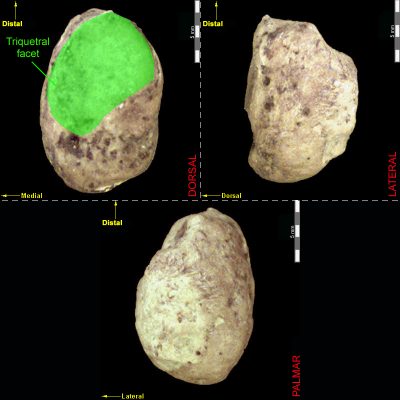 Osteology: Carpals – FORENSICS