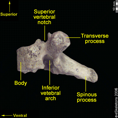 Osteology of the Vertebral Column: Thoracic Vertebrae – FORENSICS